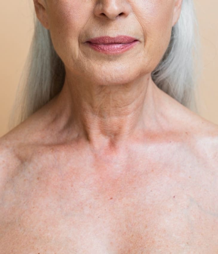 Wrinkly Hands: Causes, Prevention and Treatments | Dr Hass Clinic